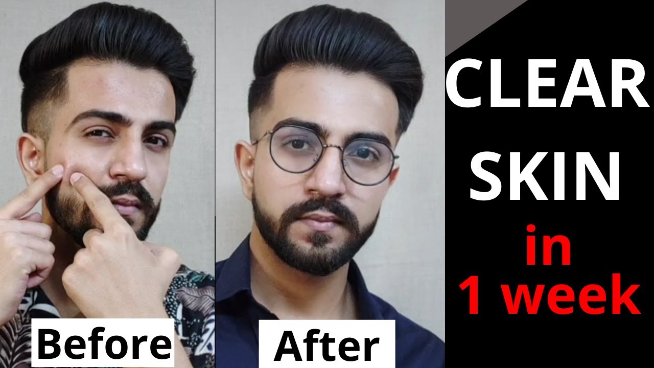 Skin Care Routine for Indian Men| Men's Skin Care | Glowing skin ...