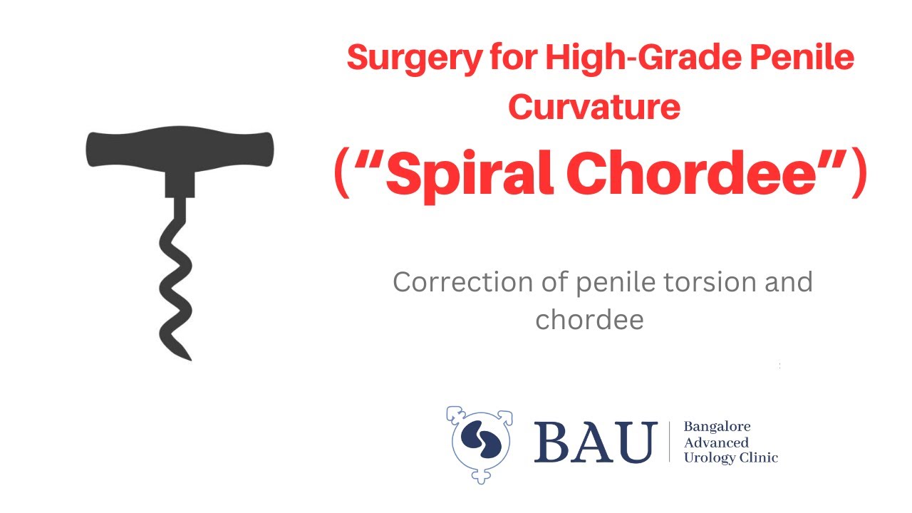 High grade penile curvature / Penile torsion with chordee (“Spiral ...