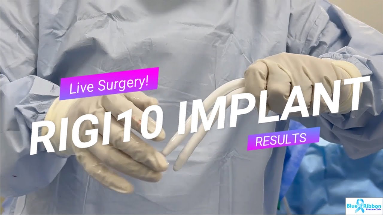 Penile Implant Live Video | Rigicon RIGI10 in 54 yrs diabetes with ...