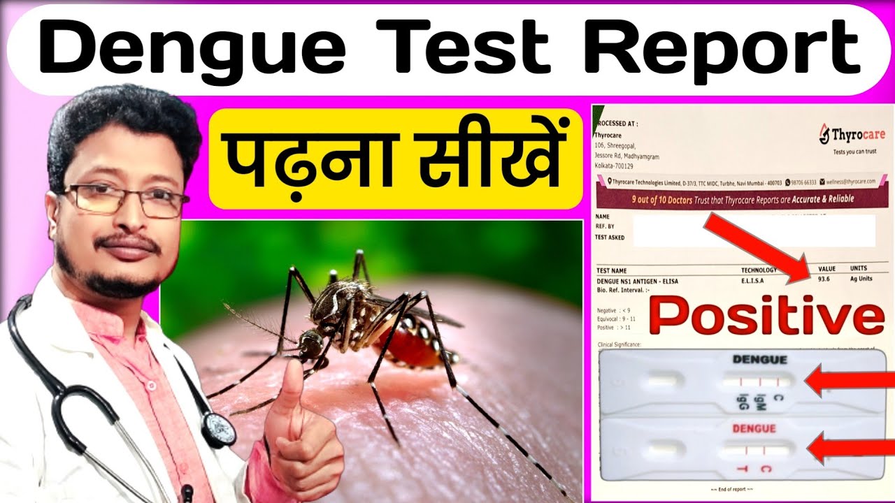 How To Read Dengue Report | Dengue Report Kaise Padhe | Dengue Test Kab ...