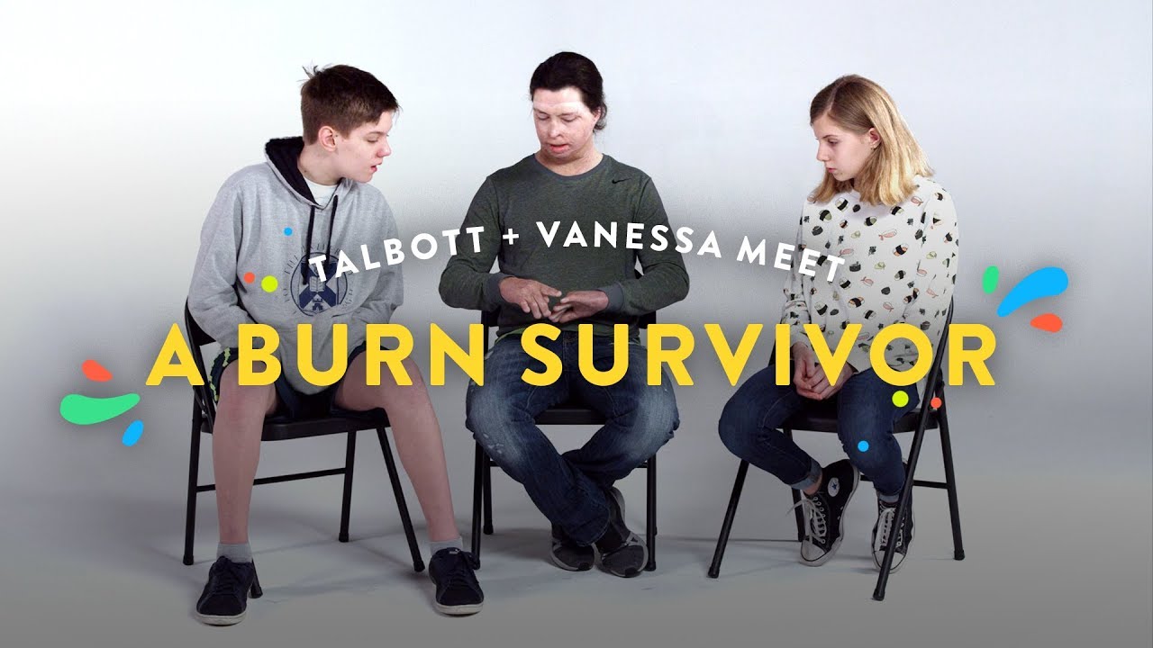 Kids Meet A Burn Survivor (Talbott & Vanessa) | Kids Meet | HiHo Kids ...