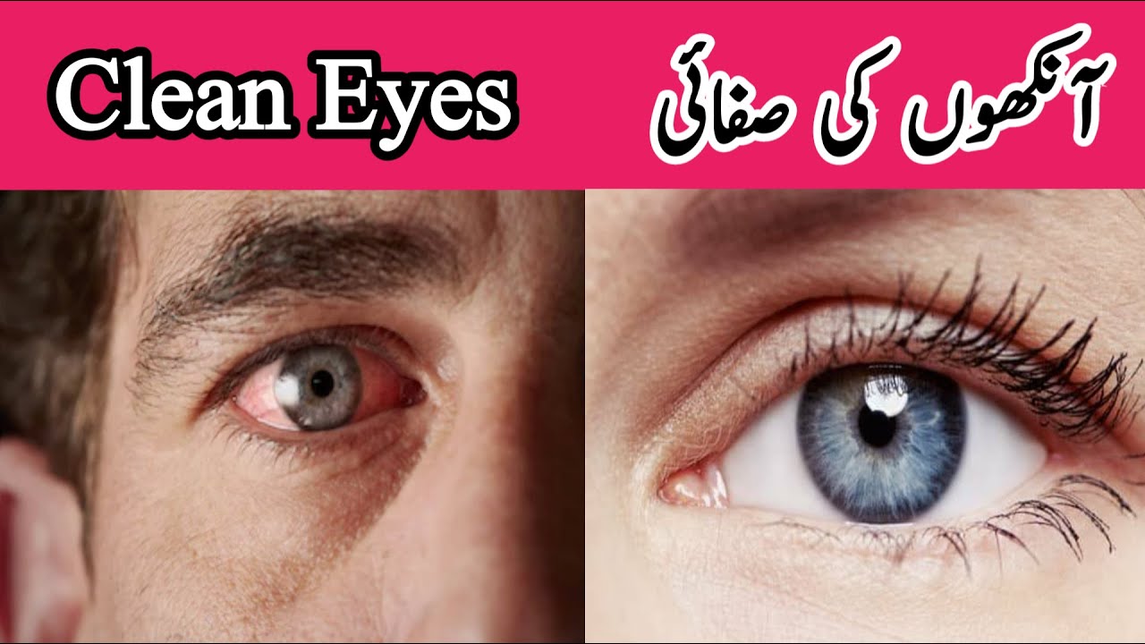 How To Get Clean Eyes | How to Get White Eyes | How to Get Bright Eyes ...