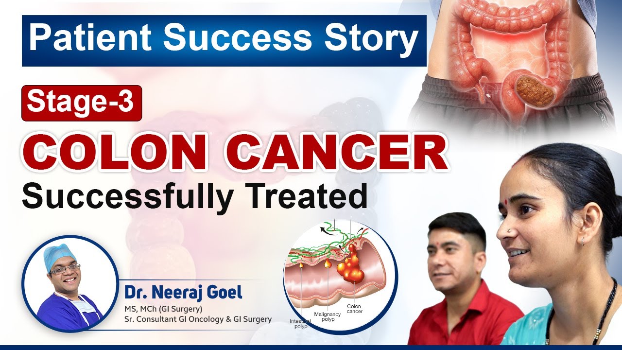 Stage 3 colon cancer-Happy patient- colon cancer! स्टेज 3 colon cancer ...