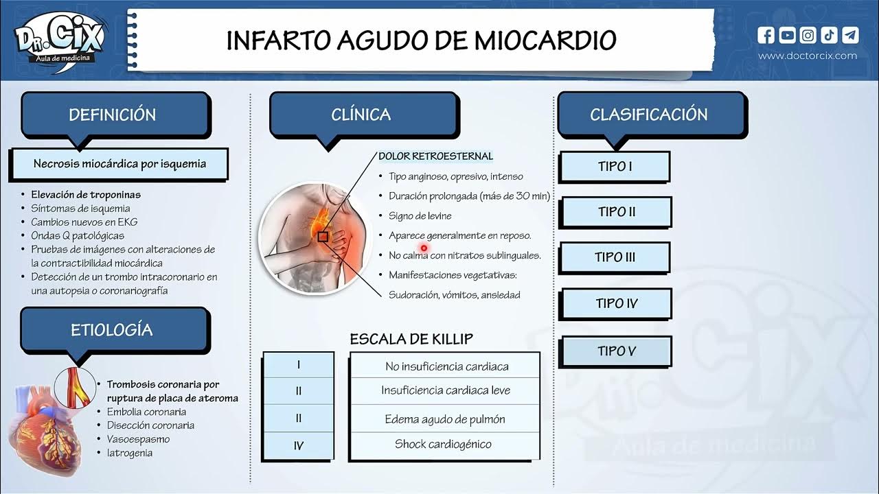 INFARTO AGUDO DE MIOCARDIO || CARDIOLOGÍA - YouTube