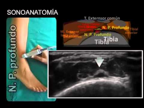 Anatomía Del Nervio Peroneo Superficial