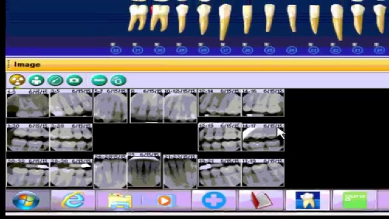 Guru Teach - integration with Dentrix and Dexis - YouTube