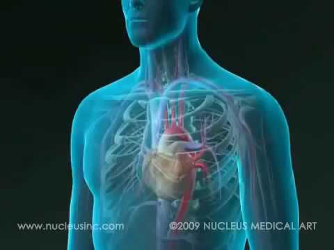 Angiography & Angioplasty Animation - YouTube