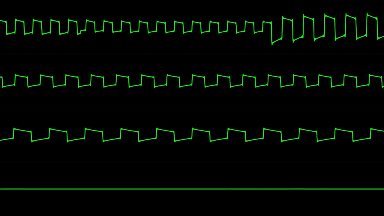 Masahiro Inoue - "Gyruss" (Full Soundtrack) [Atari 8-bit] (Chiptune ...