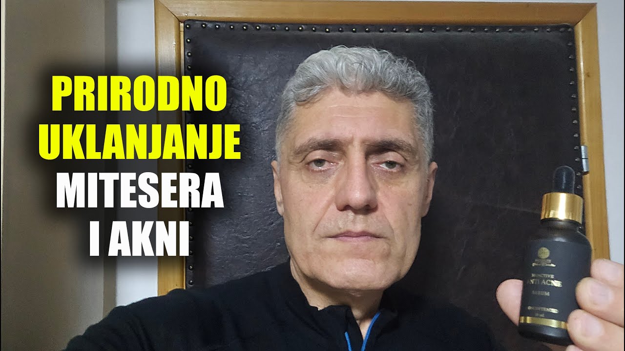 PRIRODNO UKLANJANJE MITESERA I AKNI - YouTube