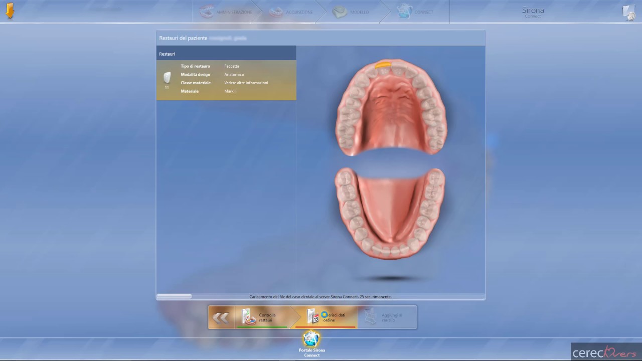 CEREC lovers - Workflow Sirona Connect - YouTube