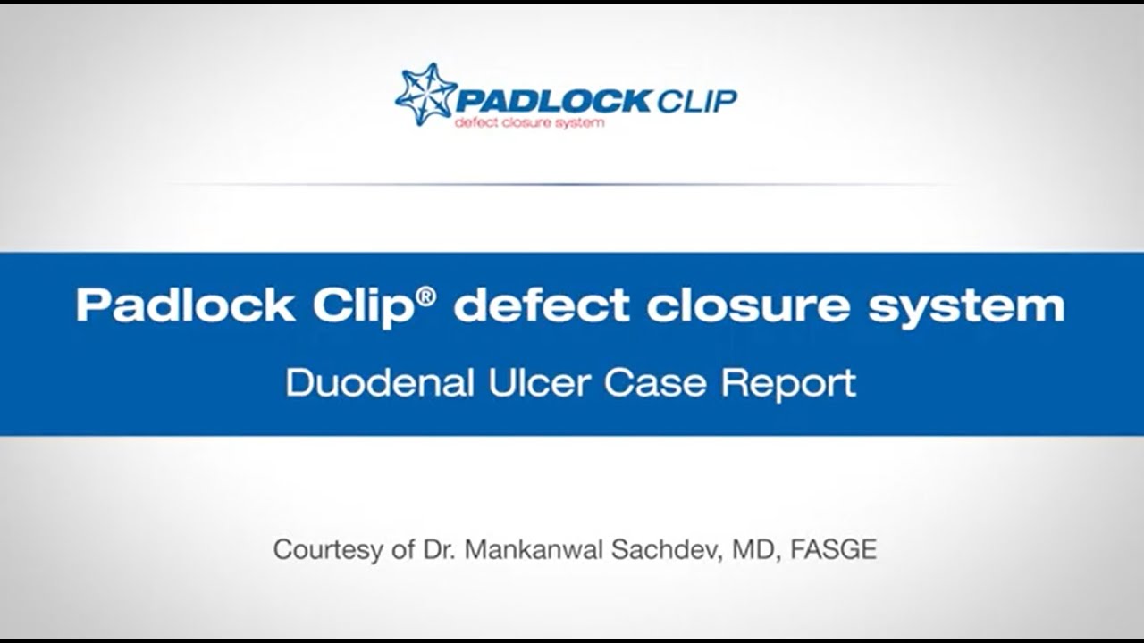 Treatment of Duodenal Ulcer with PADLOCK CLIP™ Defect Closure System ...