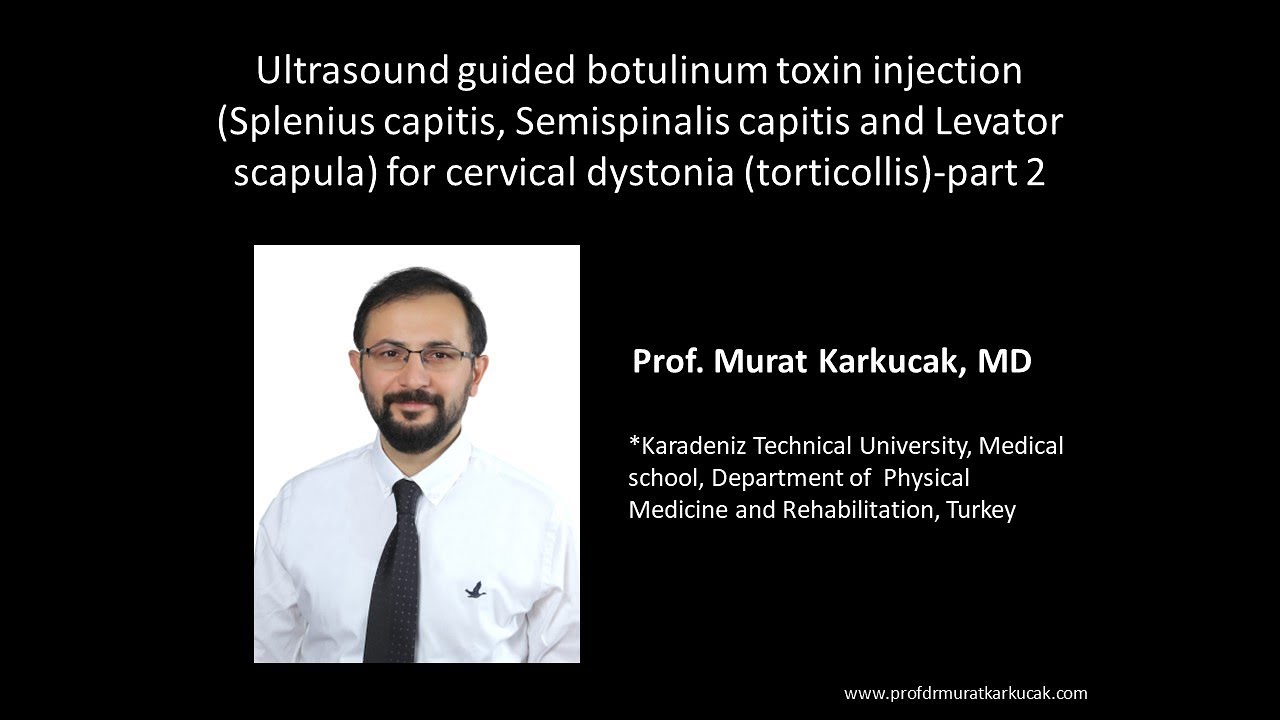 Ultrasound guided BTX injection (Splenius capitis, Semispinalis capitis ...