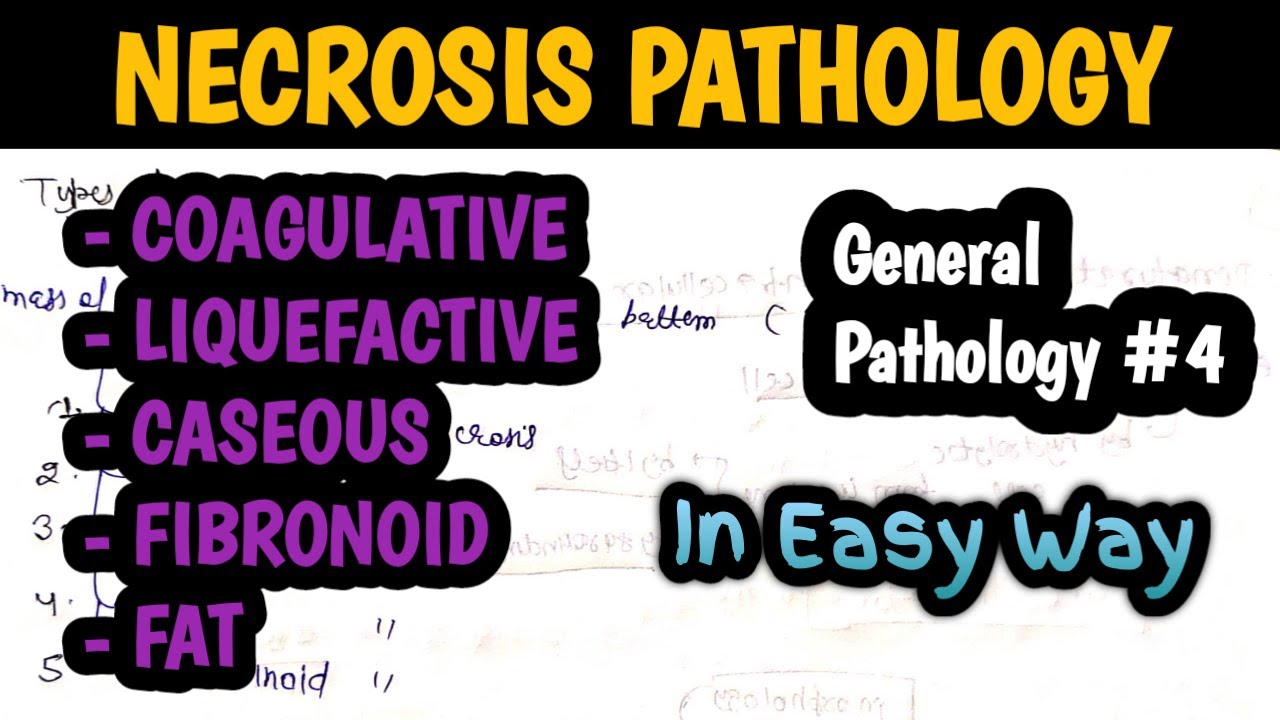 Necrosis Pathology | Types of Necrosis | Cell injury pathology ...