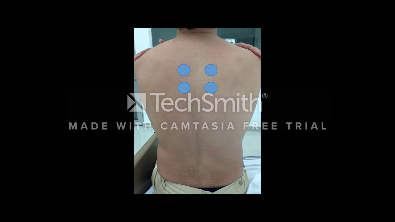 Murmullo vesicular disminuido - YouTube