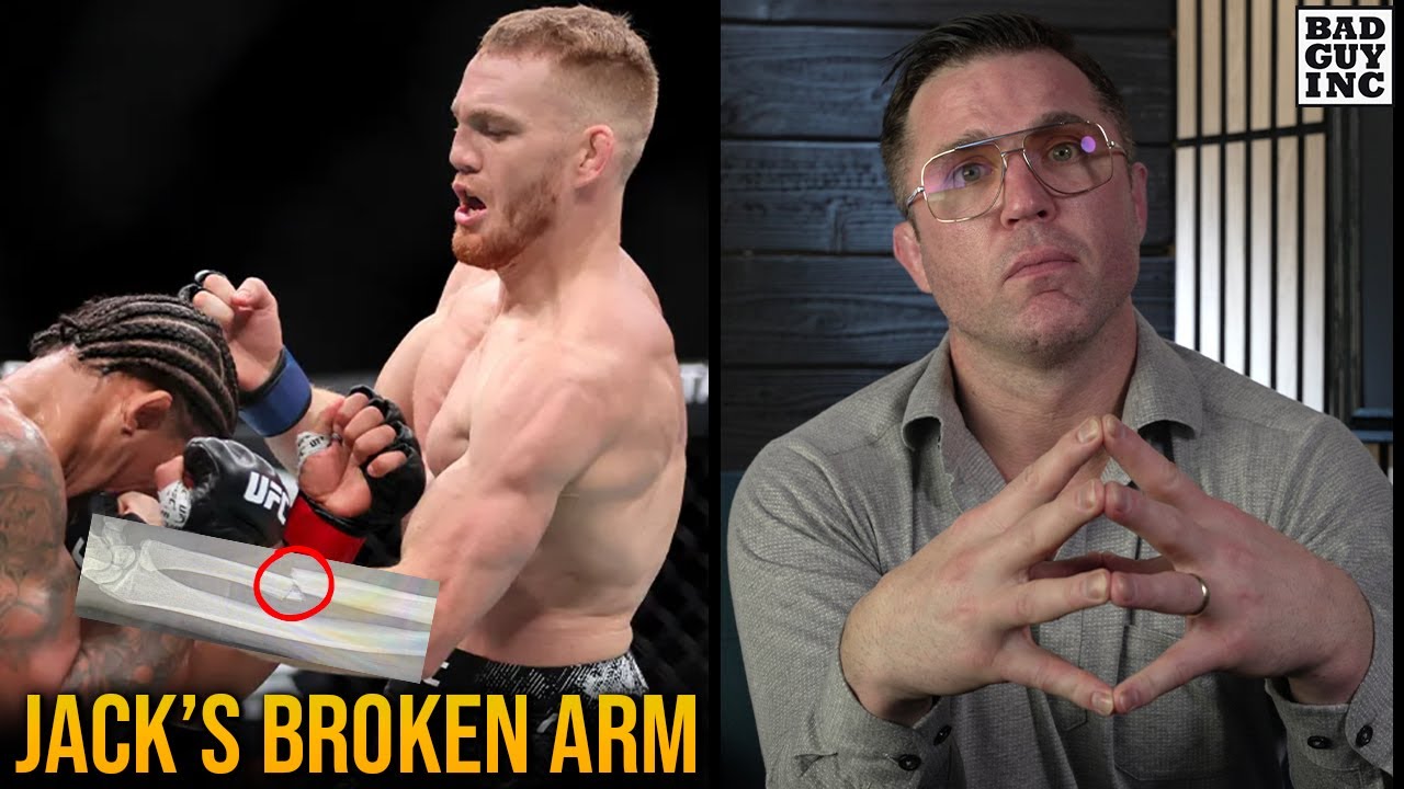 Jack’s Broken Arm... - YouTube