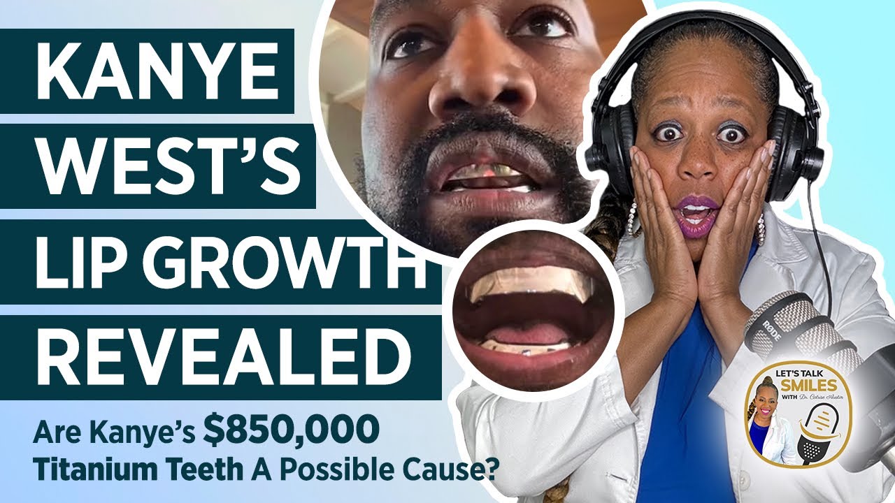 Kanye West’s Lip Growth Revealed: 5 At-Home Tips You Need to Know If ...