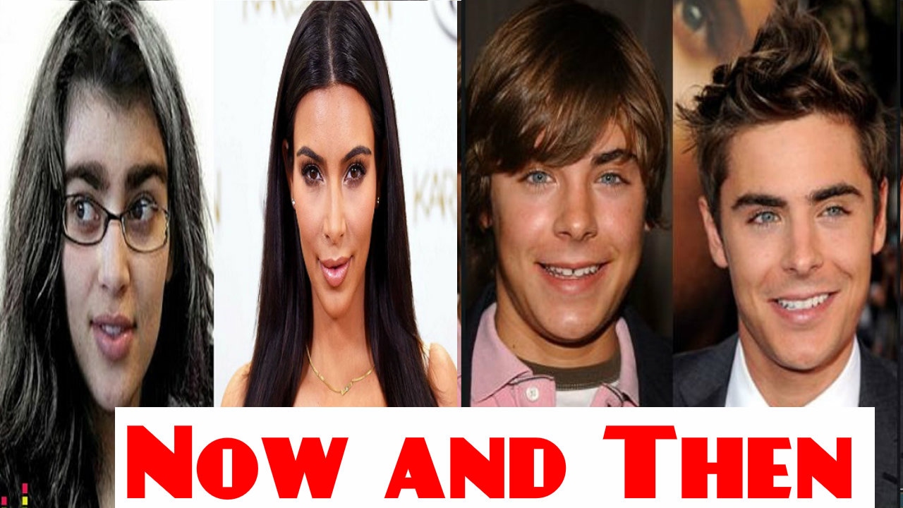 Before and After photos of Famous Celebrities 2017 - Celebrities Now ...