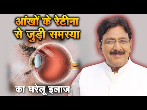 आंखों की रेटिना से जुड़ी समस्या का घरेलू इलाज | Hakim Suleman khan | Sadhna Tv