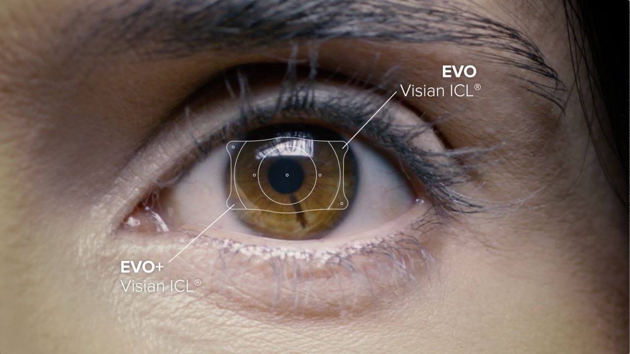 EVO Visian ICL - STAAR Surgical Corporate Video | MUNICH EYE - YouTube