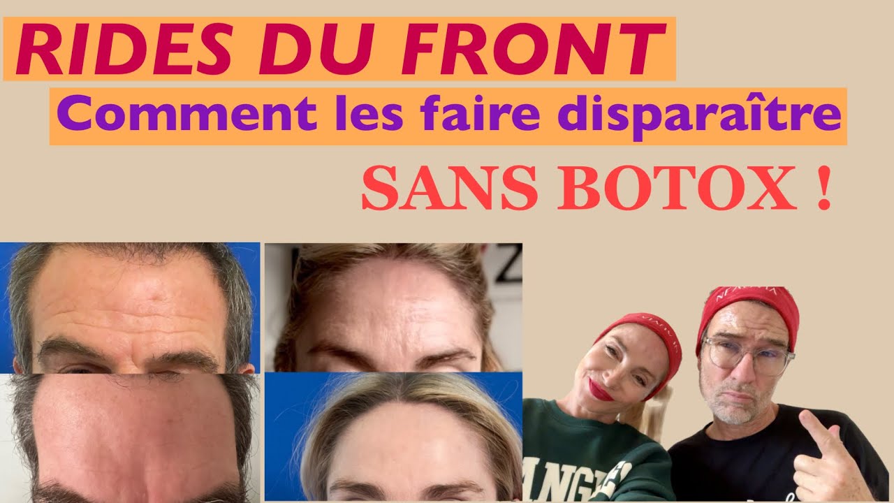 EFFACER LES RIDES DU FRONT SANS BOTOX : ON A TESTÉ ! - YouTube