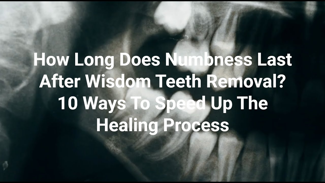 Why Is My Face Still Numb? Complete Guide to Post-Wisdom Teeth Numbness ...