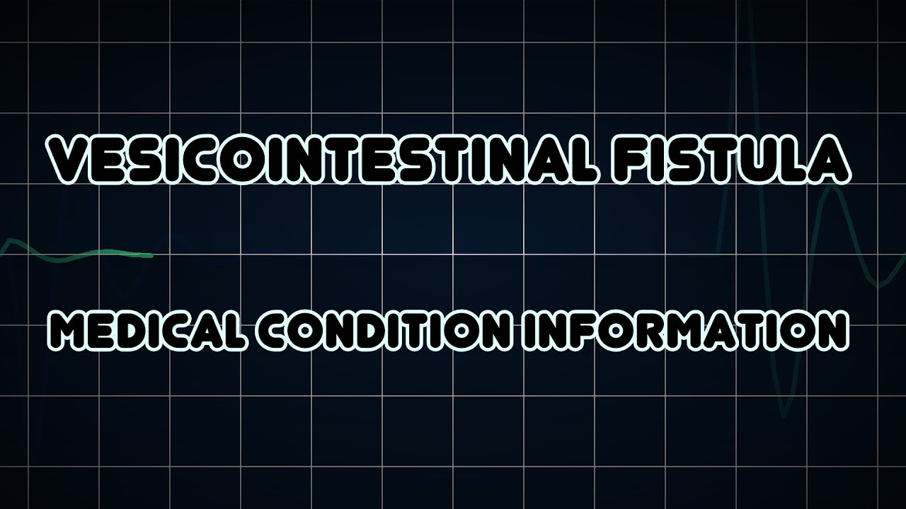 Vesicointestinal fistula (Medical Condition) - YouTube