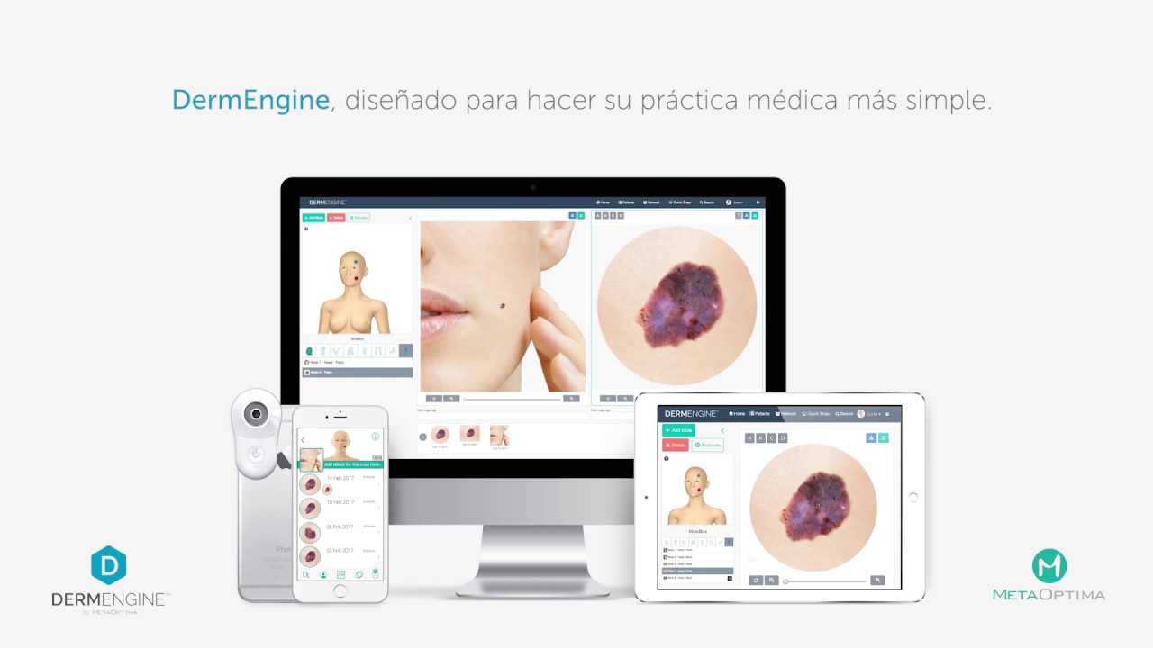 DermEngine | la moderna plataforma online para dermatología - YouTube