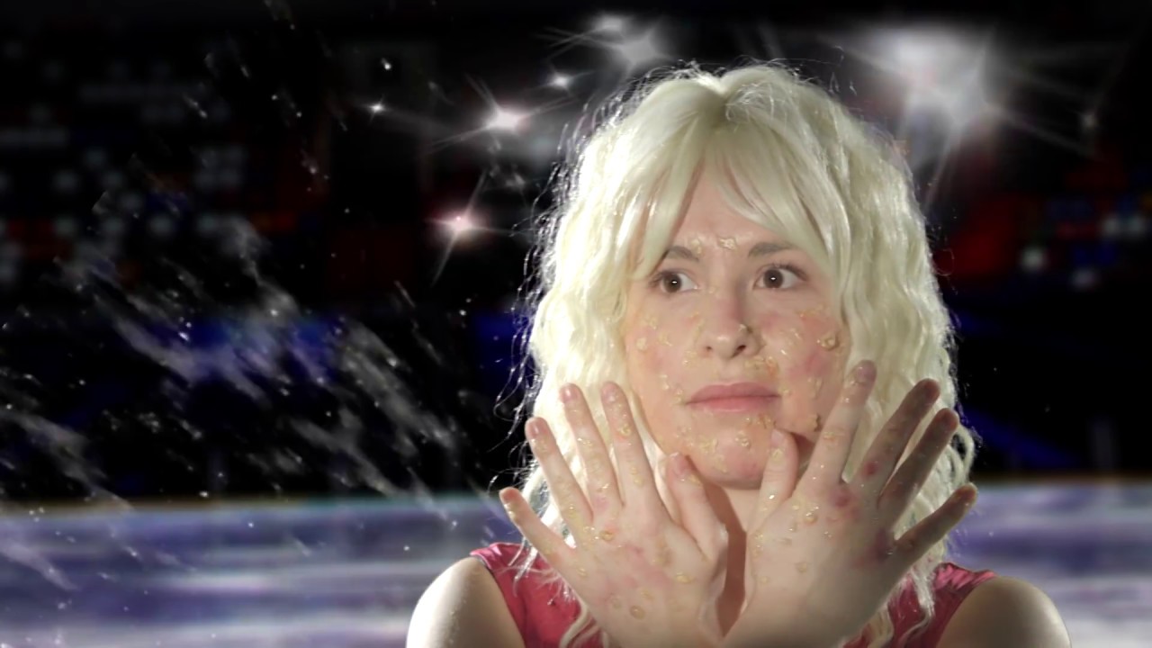Embarrasing Bodies On Ice Youtube