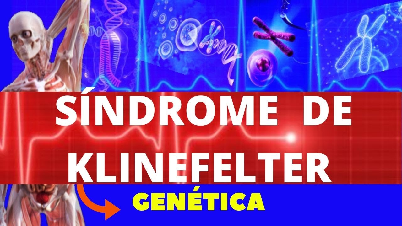 SÍndrome De Klinefelter O Que É Causas CaracterÍsticas Diagnostico E Tratamento GenÉtica