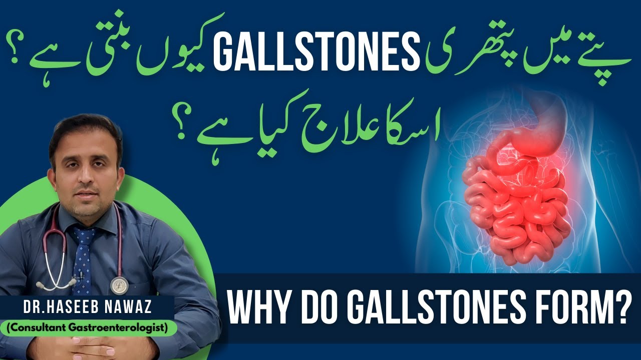 Gallstones: Why Do They Form and How Can You Treat Them? Dr. Haseeb ...