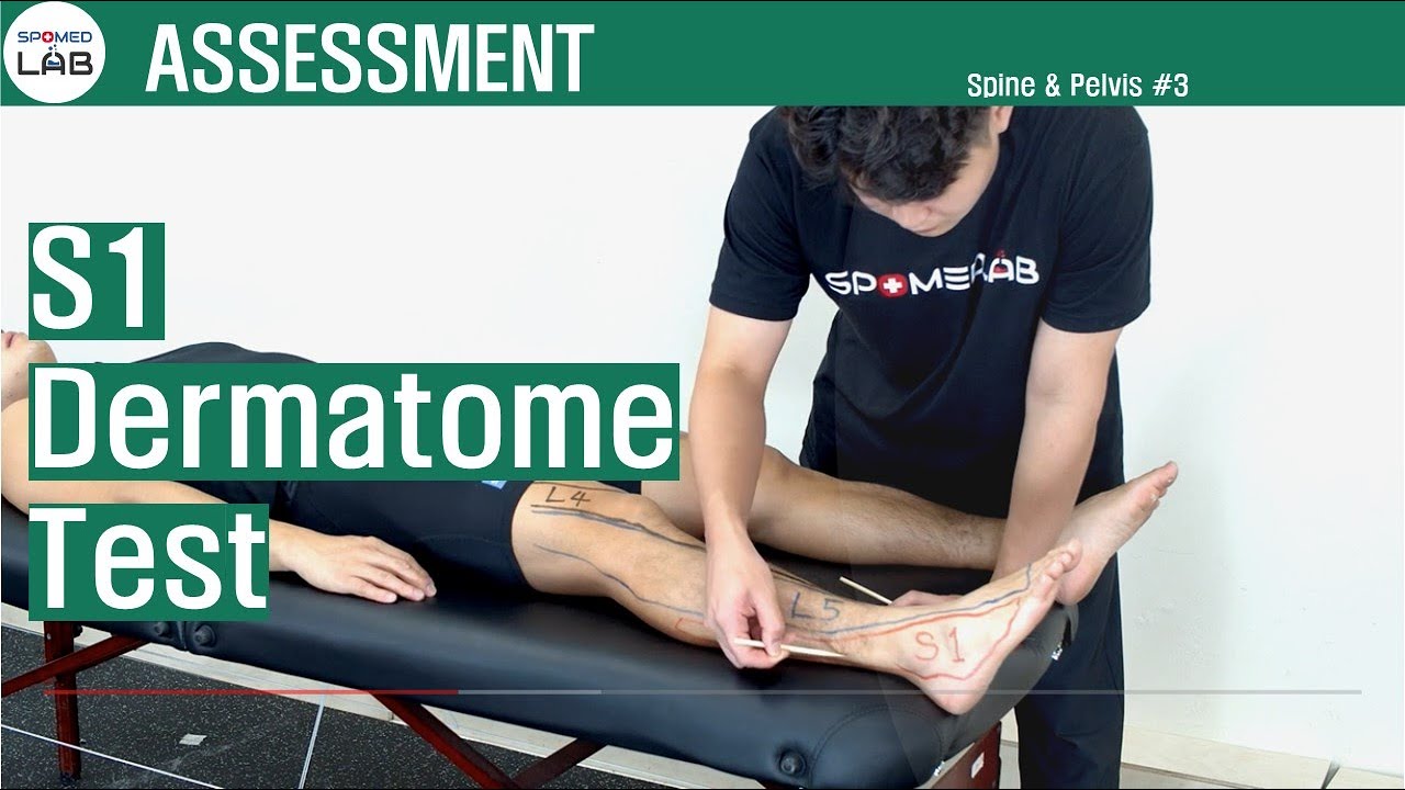 S1 Dermatome Test I 허리디스크 평가 I Lumbar Disc Herniation - YouTube