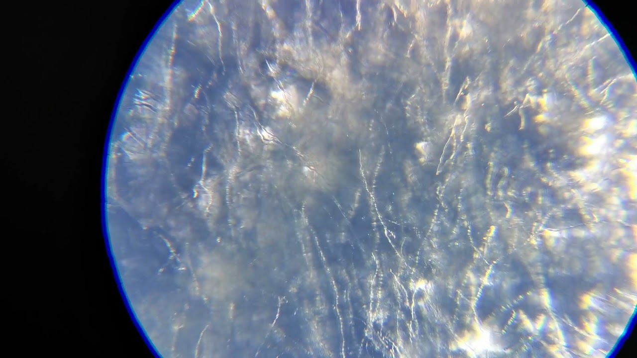 Mycelium under microscope - YouTube