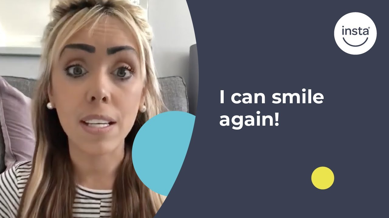 "I'm So Happy I Can Smile Again" Clip on Veneers | Instasmile Review ...