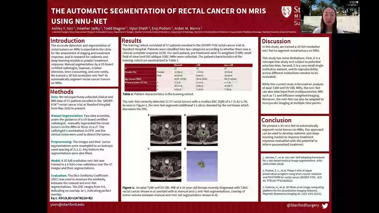 The Automatic Segmentation of Rectal Cancer on MRIs using nnU-Net - YouTube
