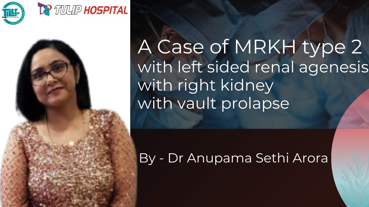 A Case of MRKH type 2 with left sided renal agenesis with right kidney ...