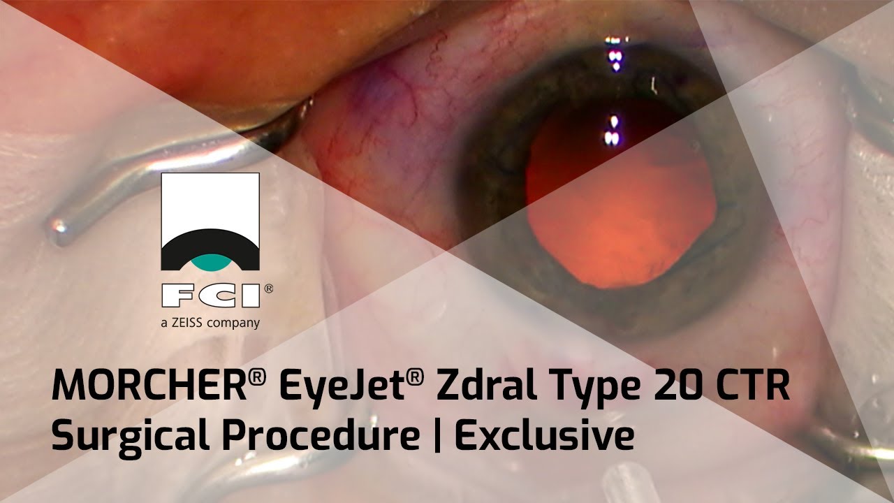 MORCHER® EyeJet® Zdral Type 20C CTR | Surgical Procedure | Exclusive ...