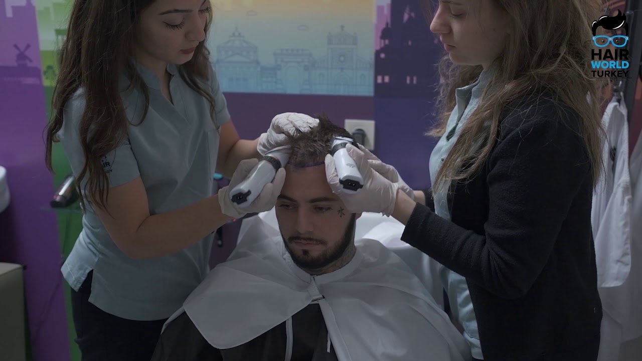 The whole Hair Transplant process with HWT Clinic - YouTube