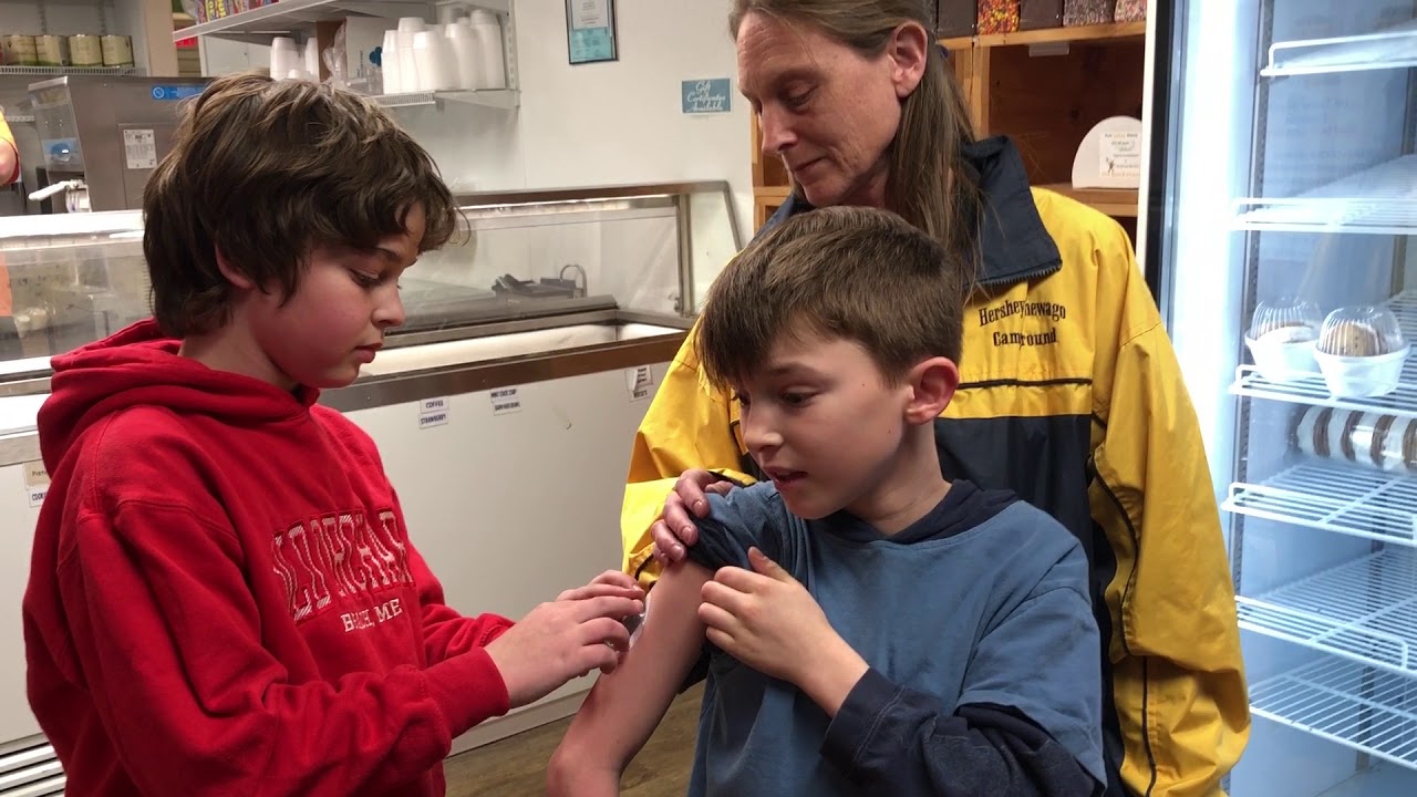 Fast Dexcom insertion for a kid, by a kid - YouTube