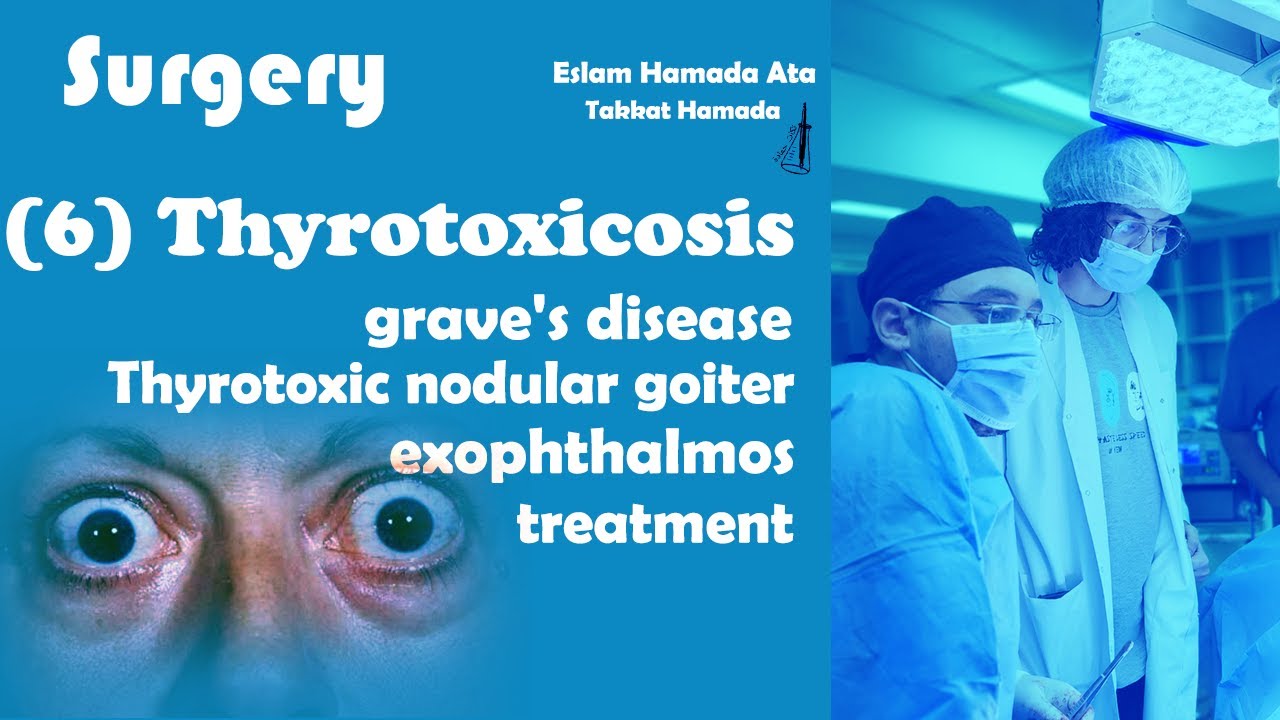 (6) Surgery - Thyroid | Thyrotoxicosis (Graves' disease - plummer ...