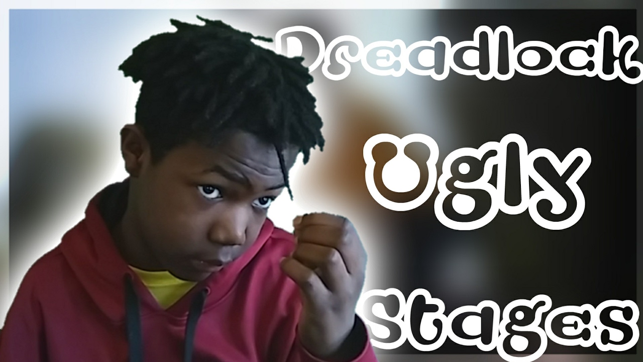 High Top Dreads | THE UGLY STAGE! - YouTube