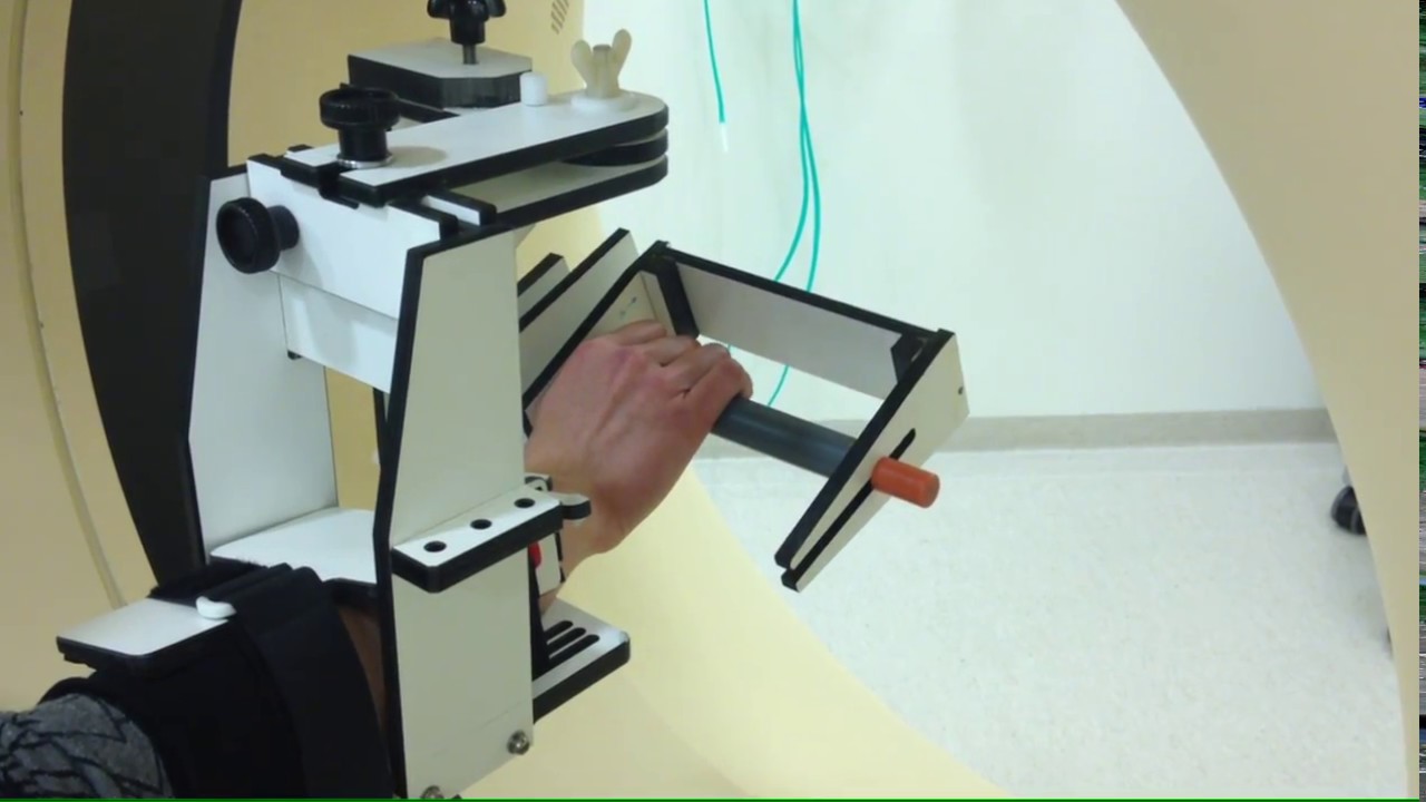 Flexion-extension motion - 4D CT scanning - YouTube