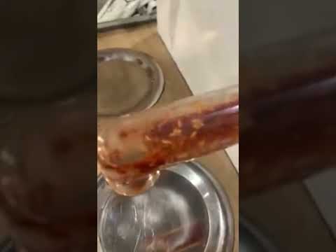 Does Ketchup Have Insects In It