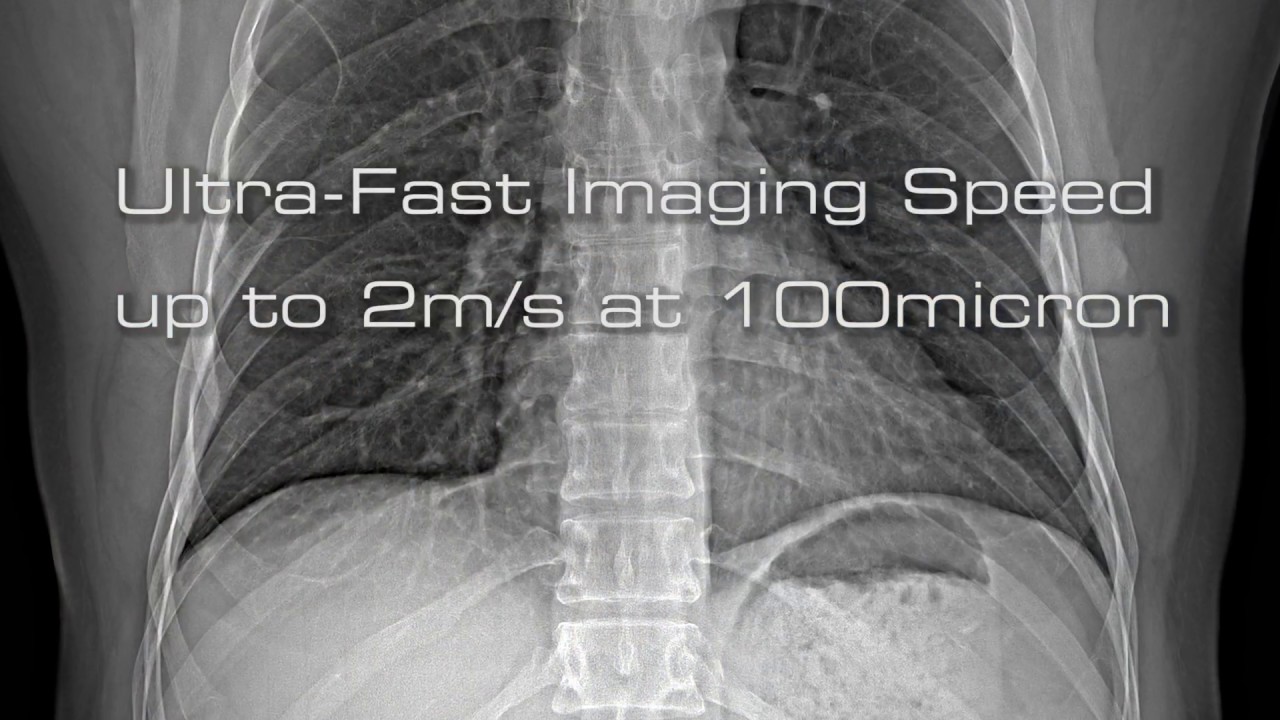 Direct Conversion: leading X-ray imaging technology - YouTube