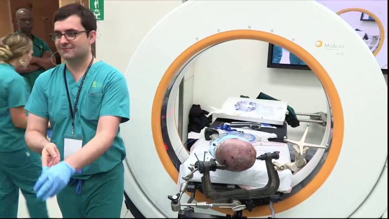 Lab Demo - MRI Guided Laser Amydalohippocampectomy with Visualase by ...