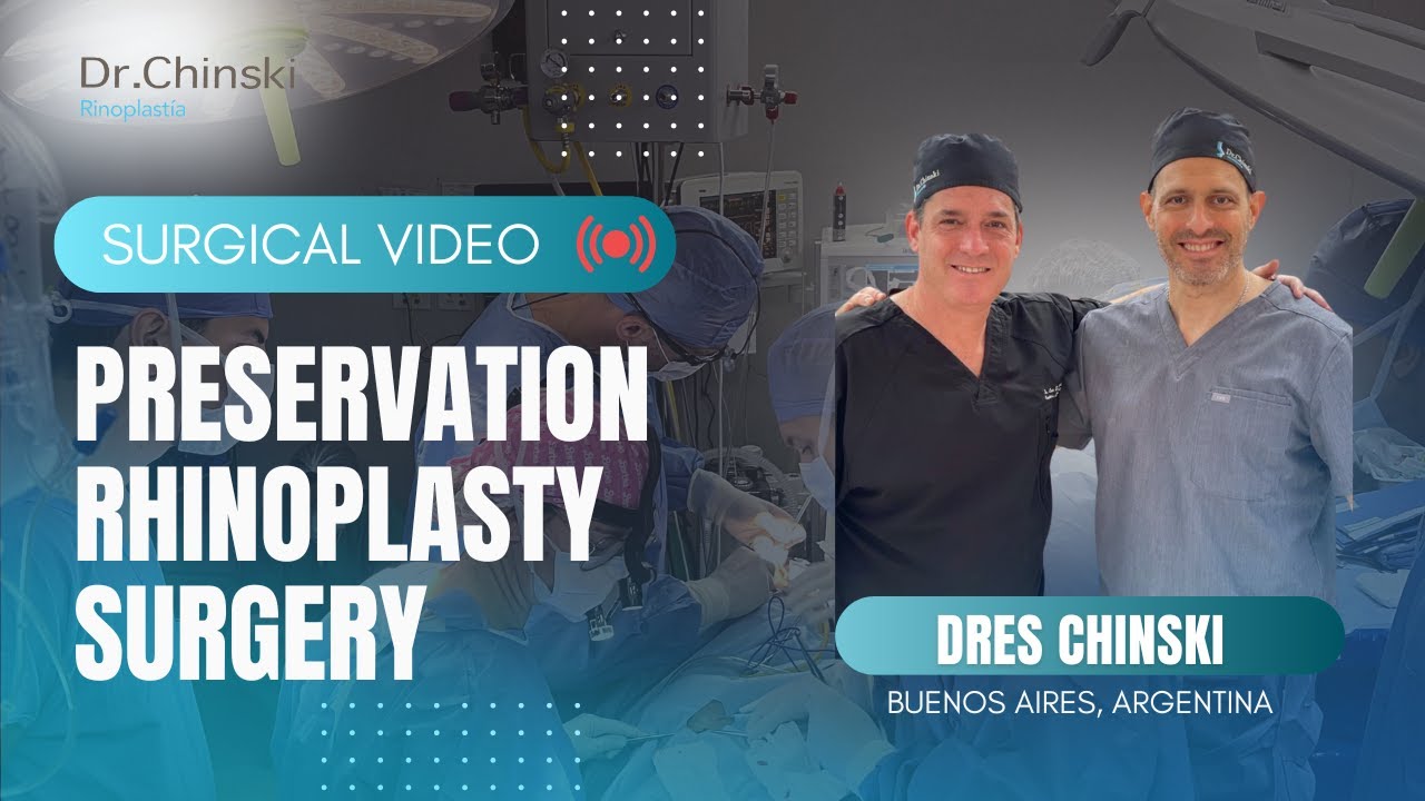 Preservation Rhinoplasty + Tip Support + Tip Definition. Dr. Chinski ...