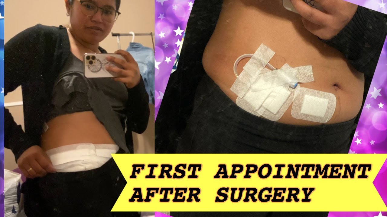 FIRST APPOINTMENT AFTER PD CATHETER INSERTION SURGERY |RaneG. - YouTube