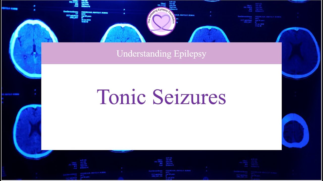What are Tonic Seizures? - YouTube
