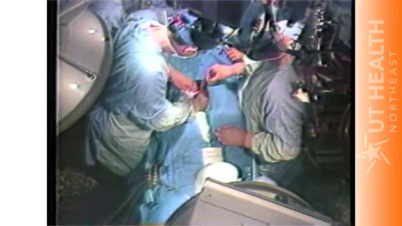 1983 Open Heart Surgery news coverage - YouTube