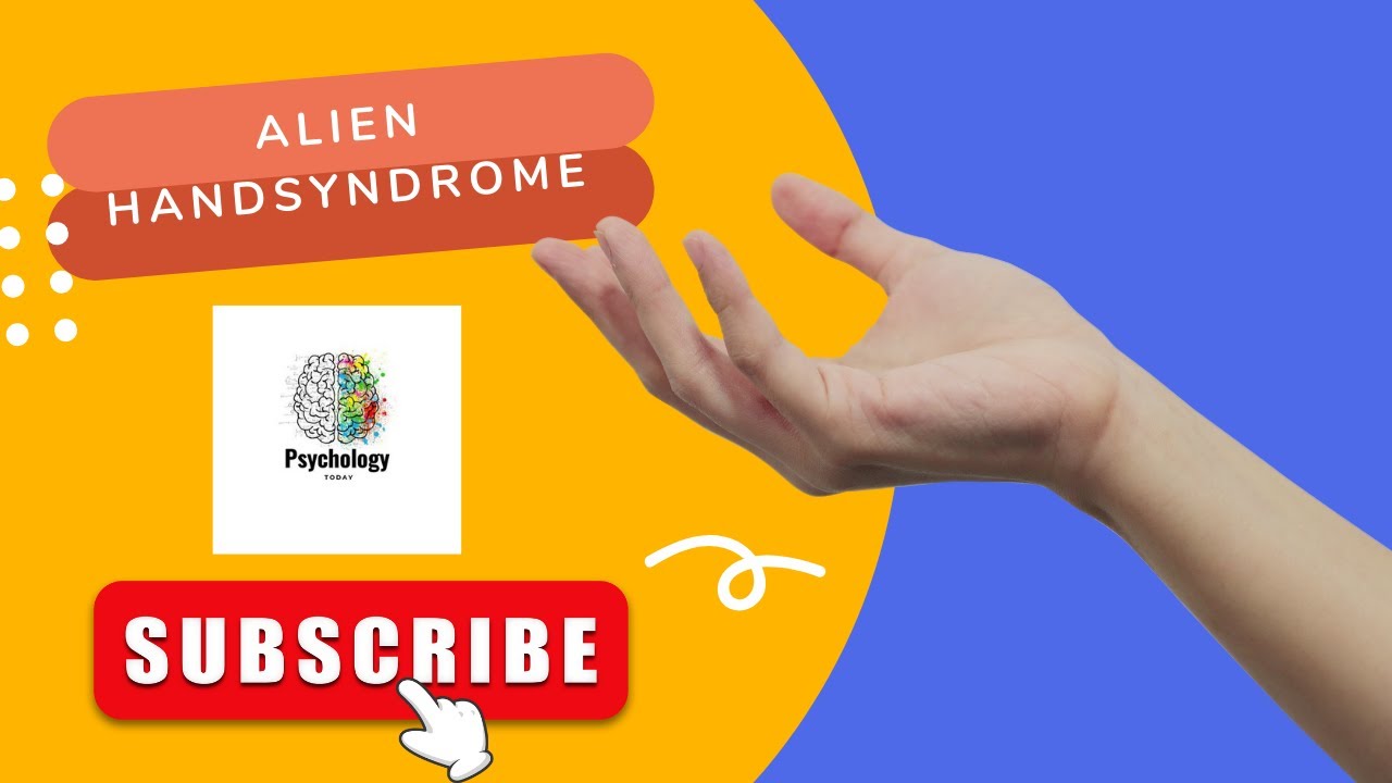 Alien hand syndrome Rare mental health condition disorder Psychology ...