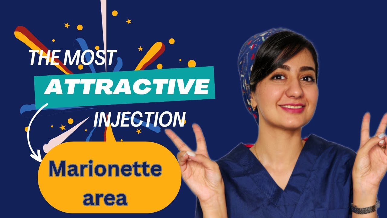 how to inject marionette area with hyaluronic acid fillers?? - YouTube